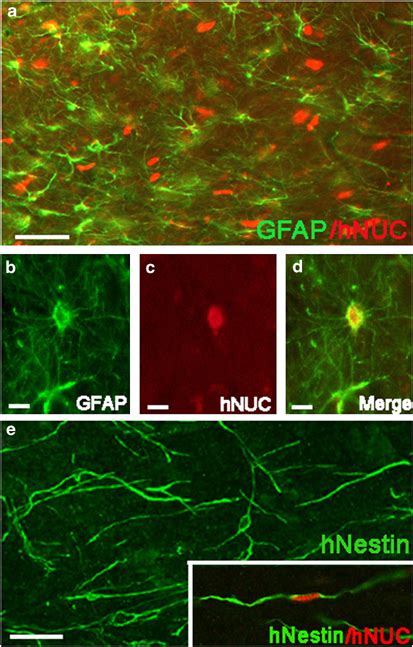 Differentiation Of Hnpc Transplanted Into The Lesioned Rodent Striatum