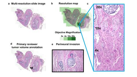 Demonstration Of Tumor Annotation On MRSI During Digital Review Download Scientific Diagram