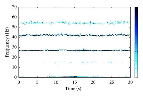 Reassigned Scalogram Of Normal Signal Download Scientific Diagram