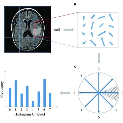 Hog Feature Extracted From The Mri Image A The Mri Image Divided Download Scientific