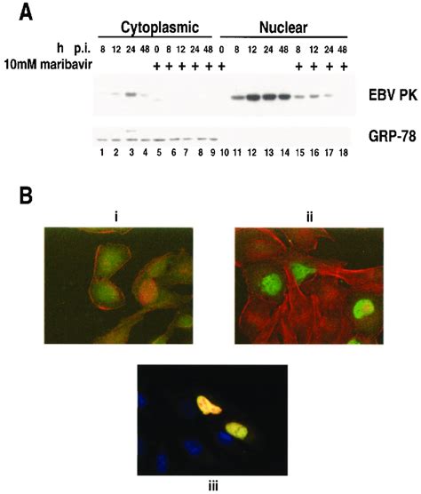 Subcellular Localization Of Ebv Pk A Akata Cells Were Collected At