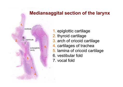 Larynx Histology Slide Labeled