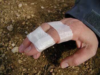 Fractured Pinky Finger Health And Medicine Thailand News And Discussion Forum ASEANNOW