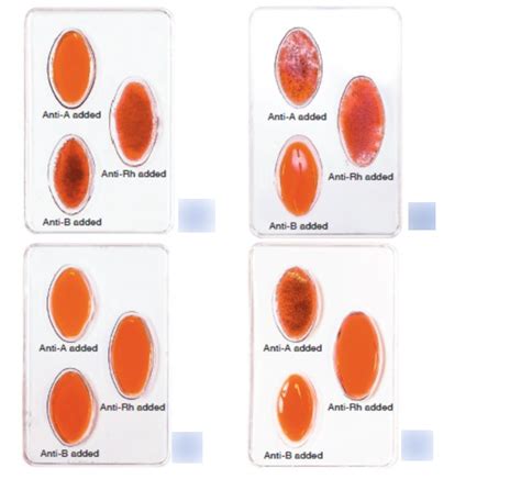 Chapter 9 Post Lab Assignments Diagram Quizlet
