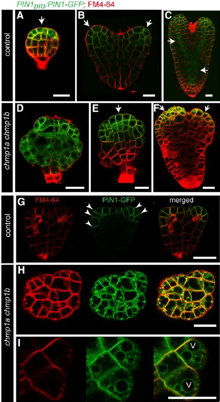 Pin1 Gfp Expression And Localization In Control And Chmp1a Chmp1b Download Scientific Diagram