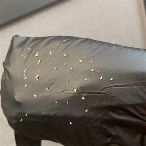 [잡담] 혐주의 압출 사진 볼사람 인스티즈 Instiz 일상 카테고리