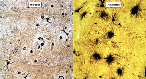 The Role Of Microglia And Astrocytes In Inflammation Cobbers On The Brain