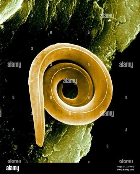 Is A Nematode A Segmented Worm At Adela Spooner Blog
