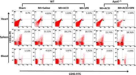 Hyperlipidemic Status Affects The Inhibition Of Dcs Infiltration In