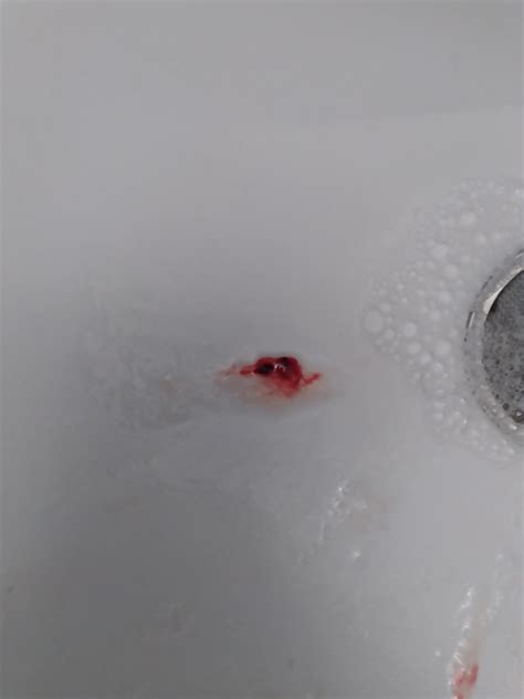 Blood In Phlegm And Snot Rmedical