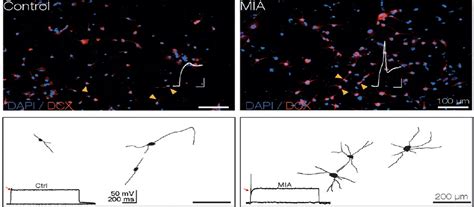The Impact Of Maternal Immune Activation On The Morphology A Neural Regeneration Research