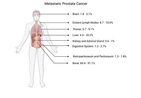 Asco Gu 2024 Differences In Genomic Transcriptomic And Immune
