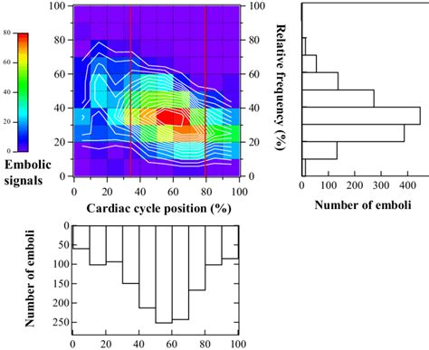 Distribution Of 1485 Embolic Signals Observed From 70 Patients