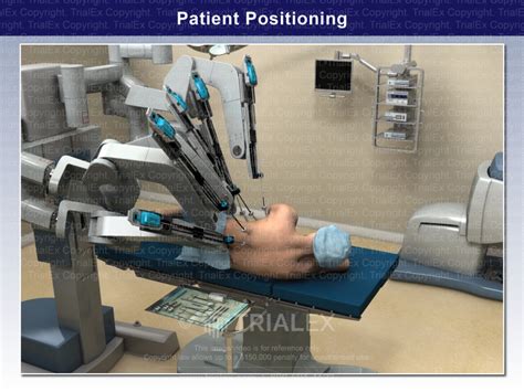Patient Positioning Trialquest Inc