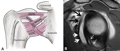 Shoulder Anatomy And Normal Variants Journal Of The Belgian Society