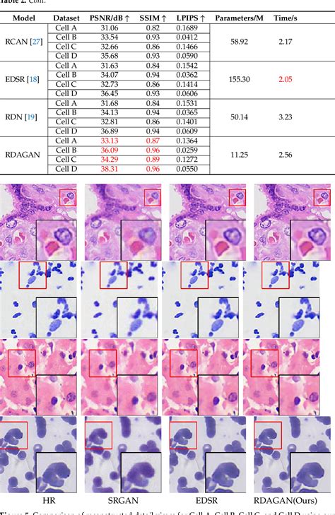 table 2 from a residual dense attention generative adversarial network