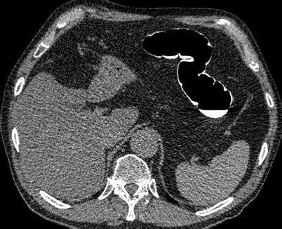 Error In Tagging Administration D Transverse CTC Image In Soft Tissue Download Scientific
