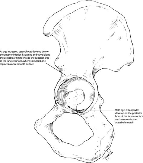 Lunate Surface Of Acetabulum