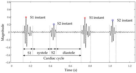 Segmentation Of Heart Sound Signal Based On Multi Scale Feature Fusion And Multi Classification