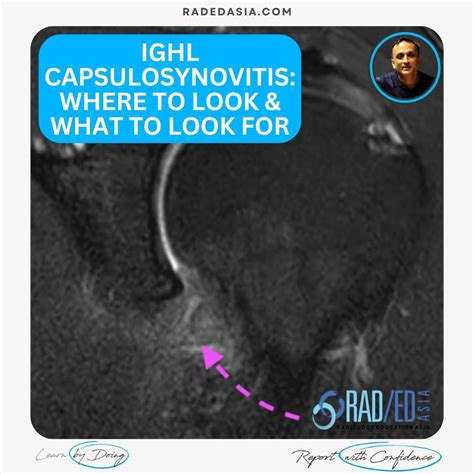 Mri Synovitis Specific Sites In The Shoulder The Inferior Glenohumeral