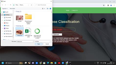 Dermai Dermatological Diagnosis System Devpost