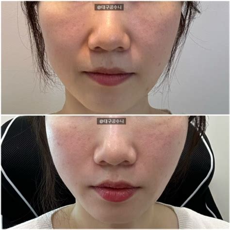 네이버 인플루언서