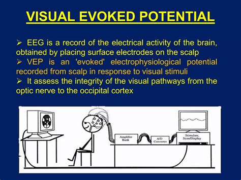 Visual Evoked Potential Ppt