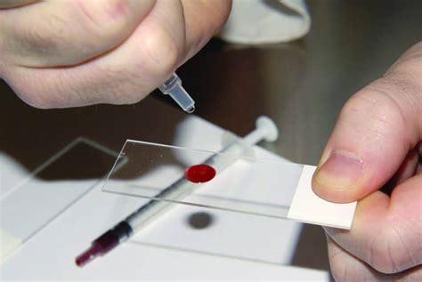 Immune Mediated Hemolytic Anemia Todays Veterinary Practice