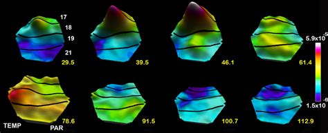 Spatio Temporal Dynamics Of The Dvmdt In Response To A Stationary