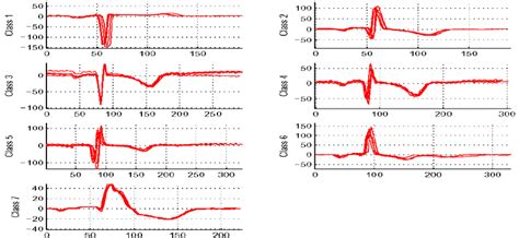 Example Of Ecg Beats Used For The Hierarchical Clustering Download High Quality Scientific Diagram
