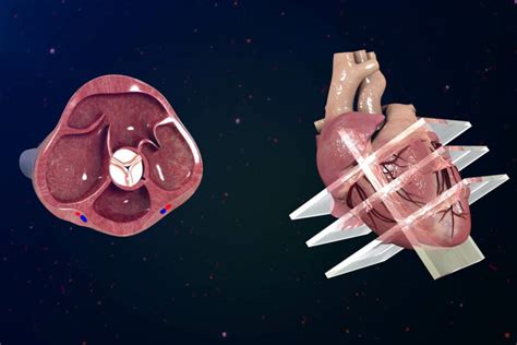 A Complete Guide To Echocardiograms