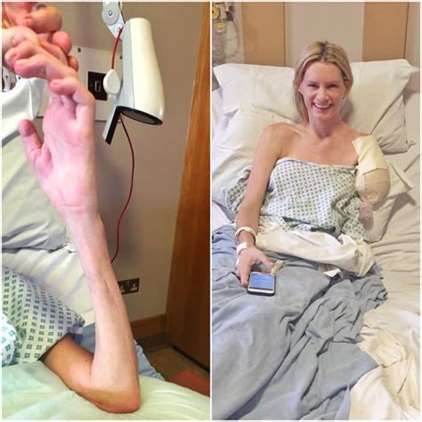Stuntwoman In Horrific Accident On Resident Evil Set Reveals Her Injuries