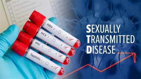 Global Sexually Transmitted Diseases Diagnostics Industry Is Predicted