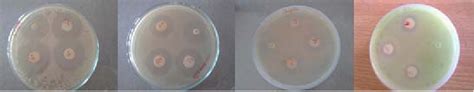 Inhibitory Activity Of Crude Bacteriocin At Different Volumes Against