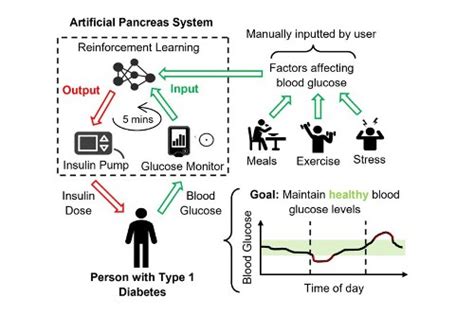 june machine learning for type 1 diabetes patients news and features