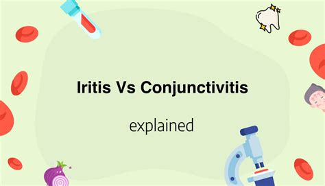 Iritis Vs Uveitis