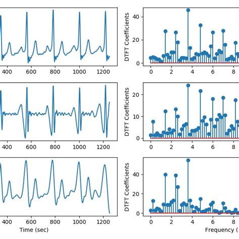 Signal Preprocessing And Filtering Step This Process Removes Most Download Scientific Diagram