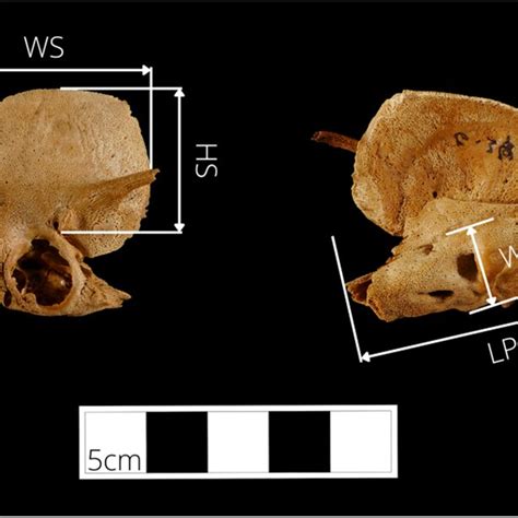 Location Of Measurements Width Of The Squamous Portion WS Height Of Download Scientific