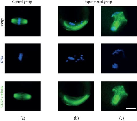 Effects Of The Cenp C Antibody On Spindle Assembly And Chromosome