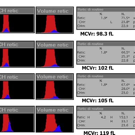 Pdf Clinical Utility Of Reticulocyte Parameters
