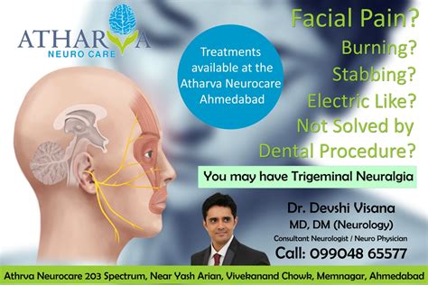 What Is Trigeminal Neuralgia Dr Devshi Visana Neurologist