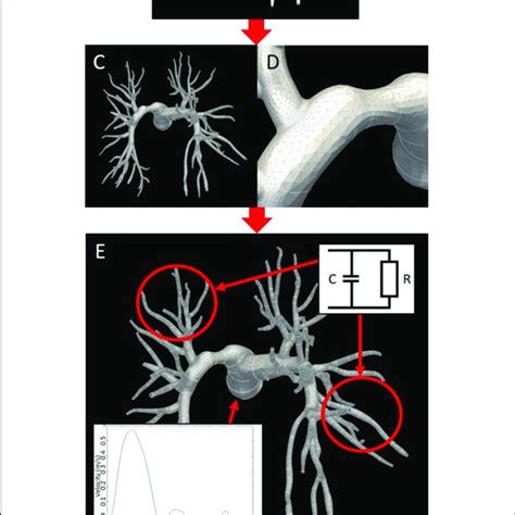 Pipeline For The Generation Of Patient Specific Models And Download Scientific Diagram