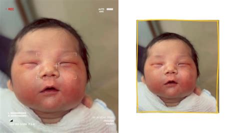 출산브이로그 제왕절개후기 제왕절ㄱㅐ회복기 제왕절개후72시간 Youtube