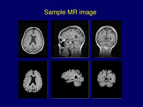 Ppt Segmentation Of Brain Tissues On Mr Images Using Data Driven
