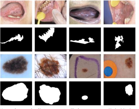 Figure 1 From Lesion Segmentation Framework Based On Convolutional