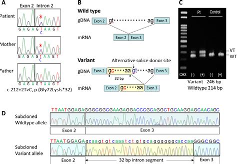 Figure 2 From A Novel Gnas Gsα Splice Donor Site Variant In A Girl With Pseudohypoparathyroidism