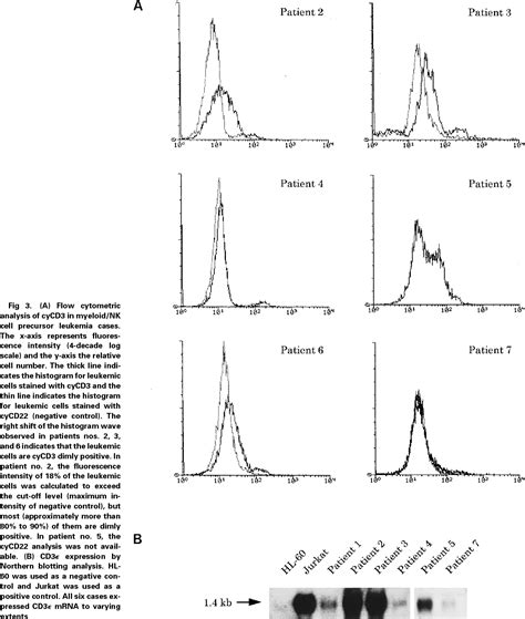 Figure 3 From Cd7 And Cd56 Myeloidnatural Killer Cell Precursor