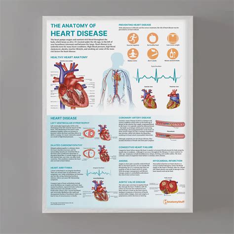 The Anatomy Of Heart Disease Chartposter Laminated Cardiovascular