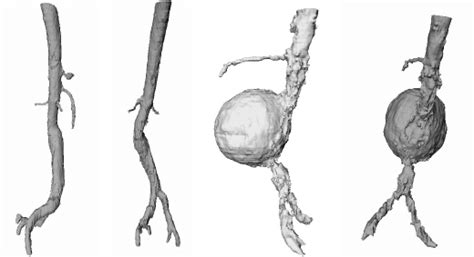 Triangulated Surface Of The Zero Level Set Formed Using The Marching