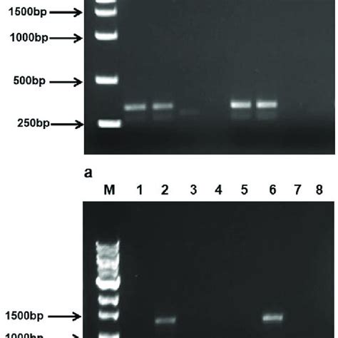 agarose gel electrophoresis lanes m dna ladder marker lanes 1 8